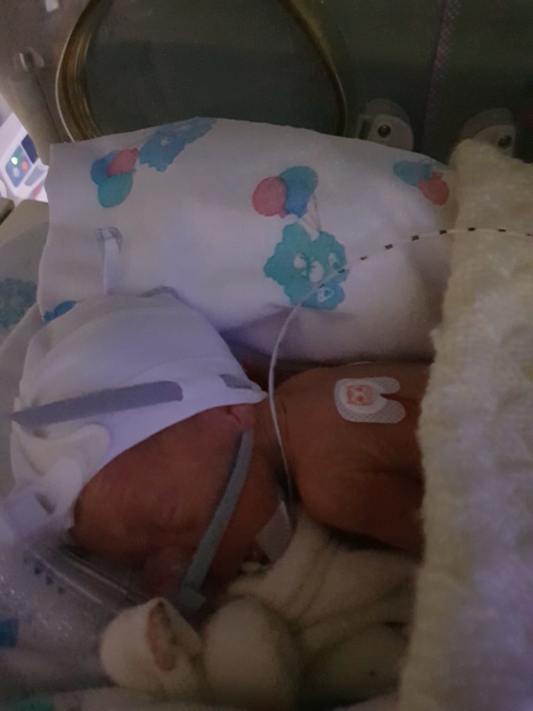 Meet 160,000-to-one identical triplets Thai, Tyler and Tomas - The ...