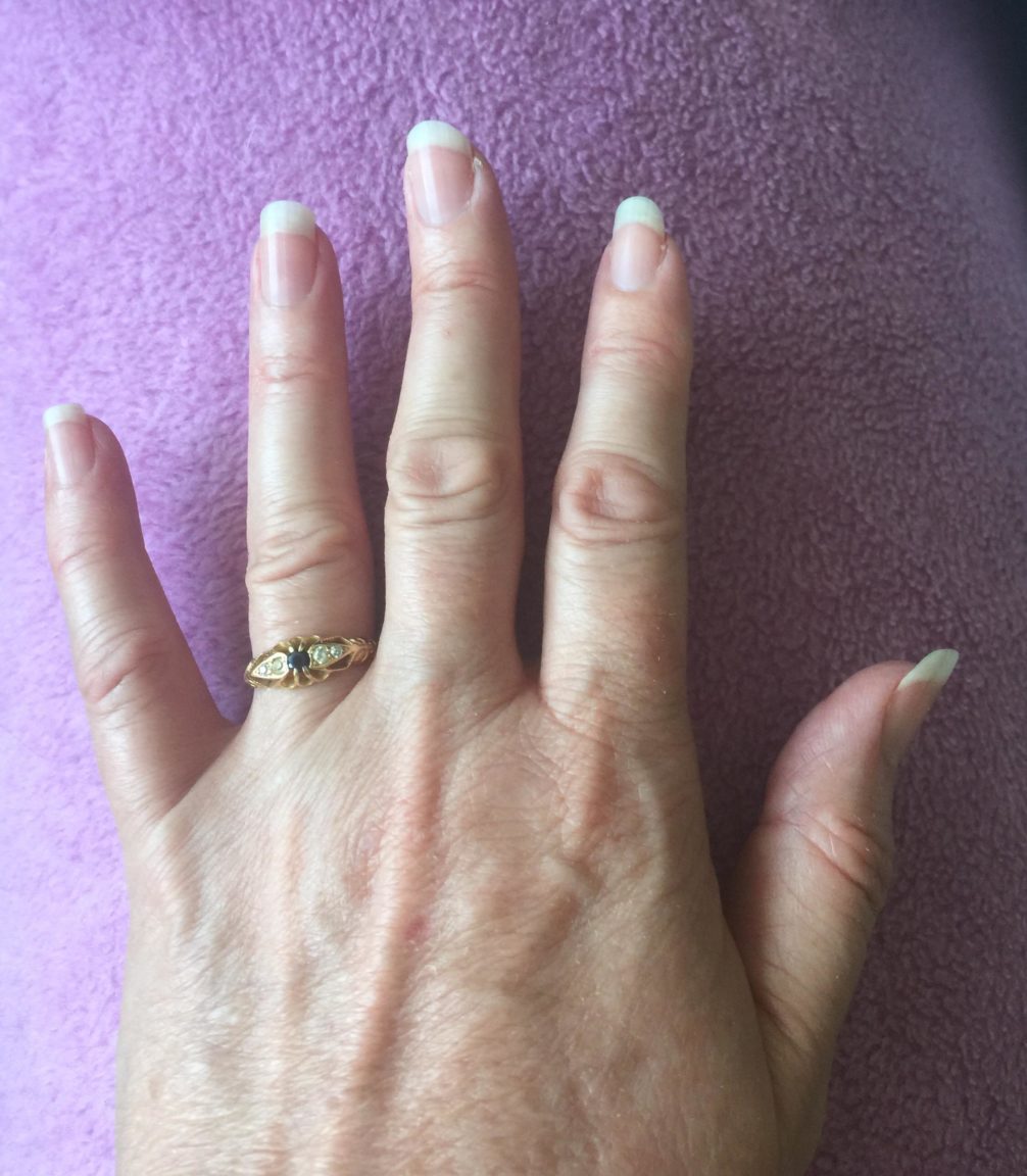 The incredible story of the 'Pitmiddle ring' - one of the last remnants ...