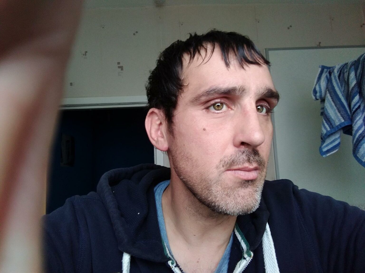 Perth nose bite victim jailed for assaulting nurse who treated him