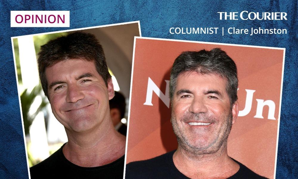We can all learn from Simon Cowell when it comes to Botox and fillers