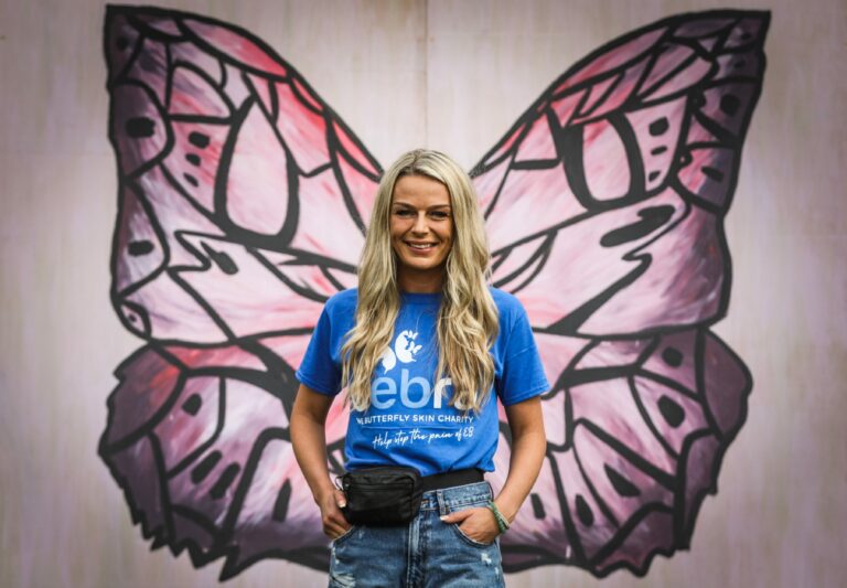Montrose festival for charity DEBRA honours 'butterfly girl' Adana