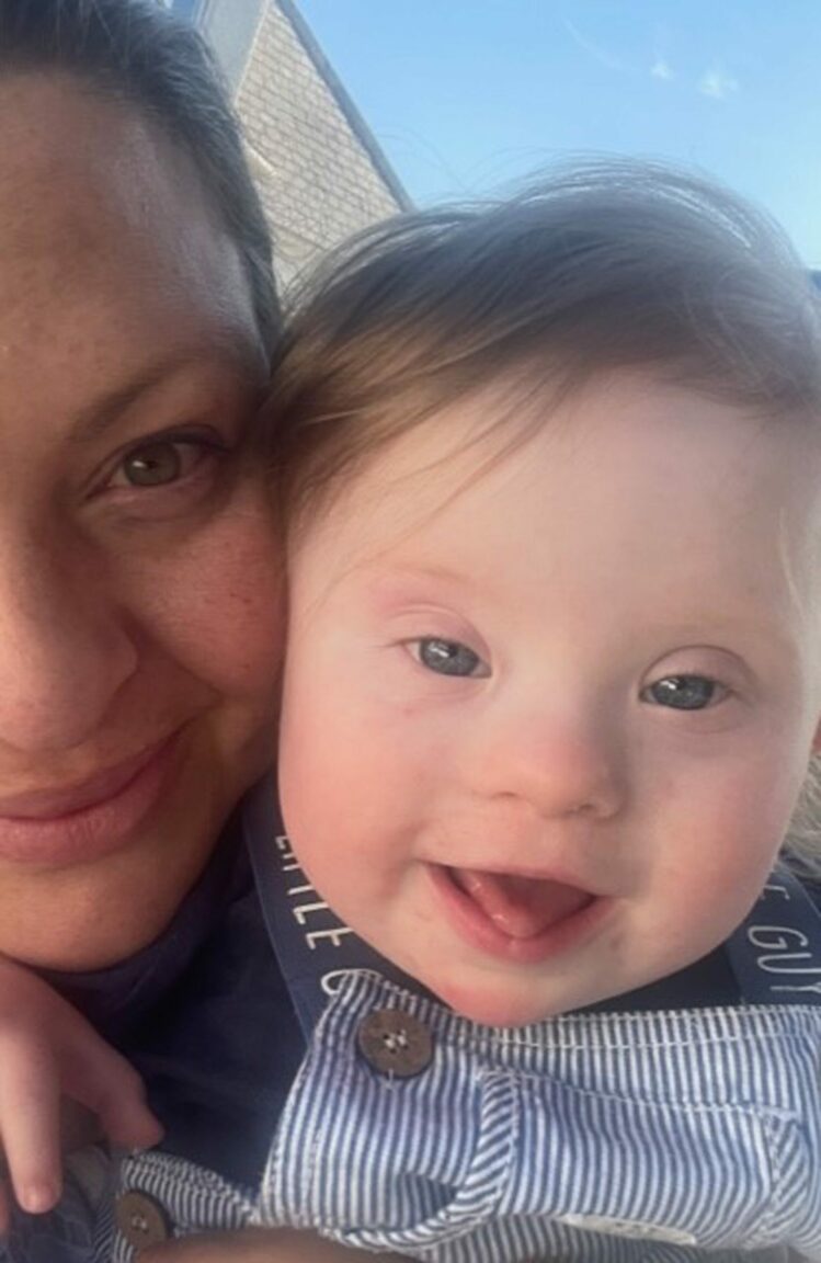 Arbroath baby with Down's syndrome thriving after heart surgery