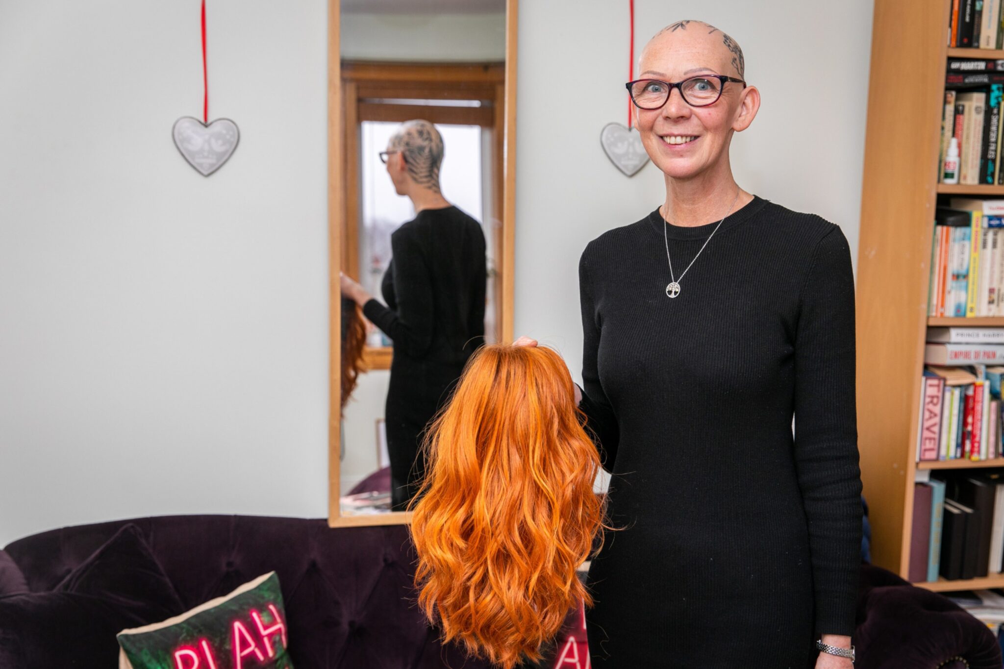 Fife woman Ali shares her experience of living with alopecia