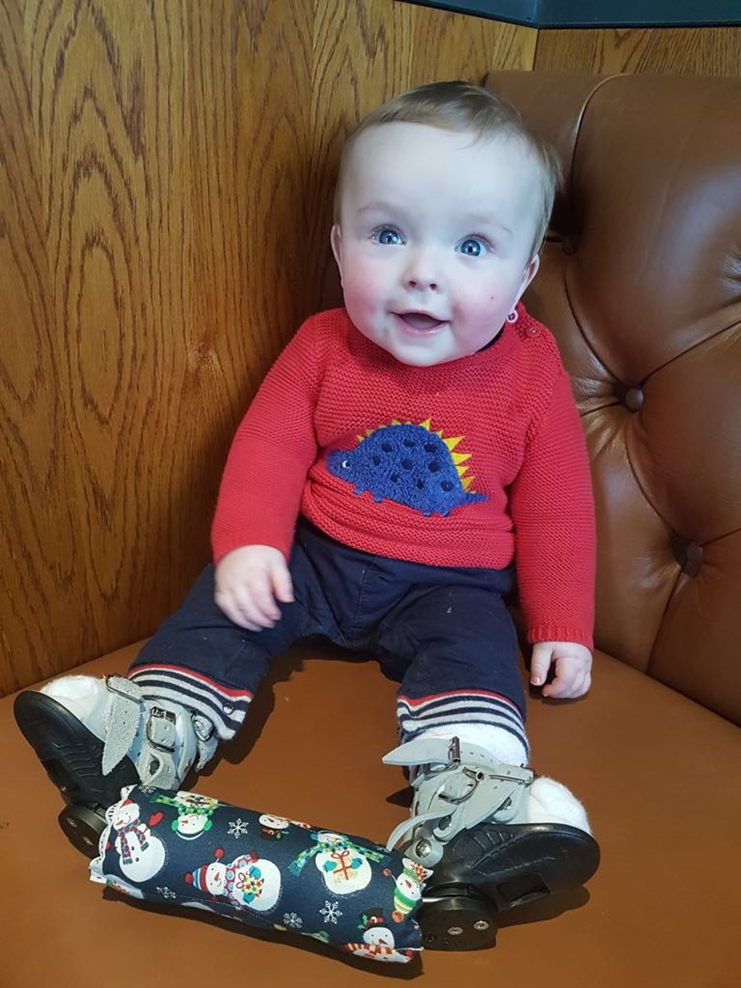 Sports day was extra special for Kirkcaldy boy born with clubfoot