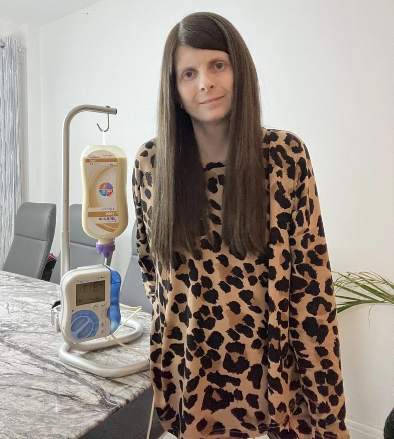 How a DNA project led to Dundee woman's rare disease diagnosis