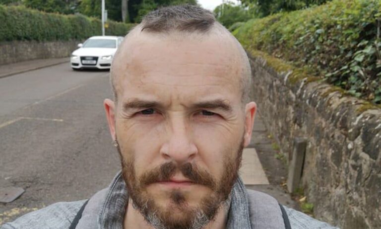 Dunfermline brawler left rival needing metal plates fitted in his face