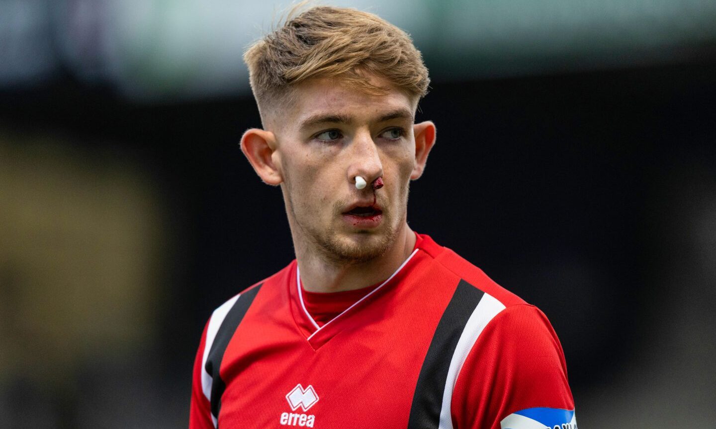 Dunfermline: Lennon's 'brutal honesty' is OK with Robbie Fraser