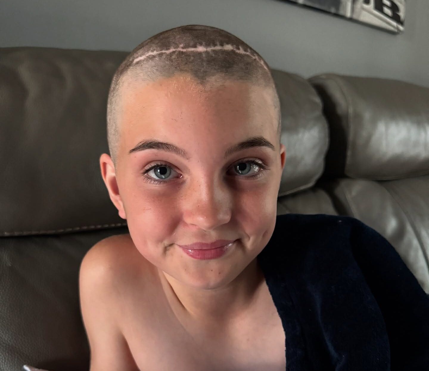 Kirkcaldy family hope second brain op will end Myla Ray's seizures