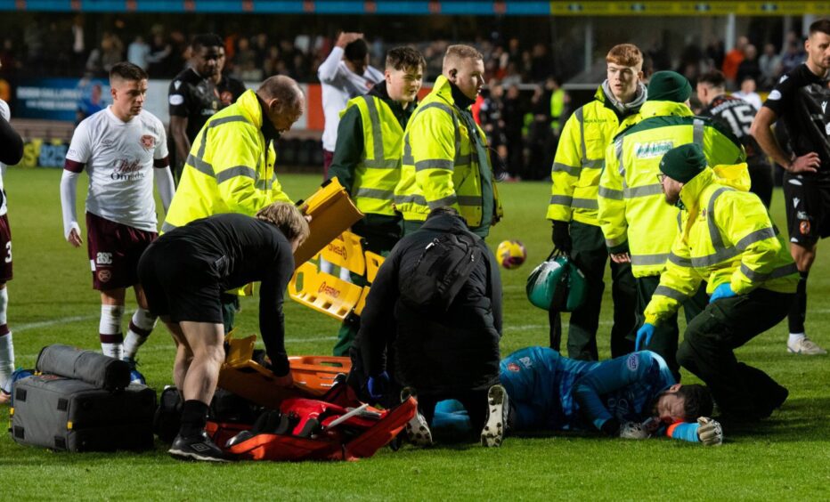 Craig Gordon recalls Dundee United double leg break horror
