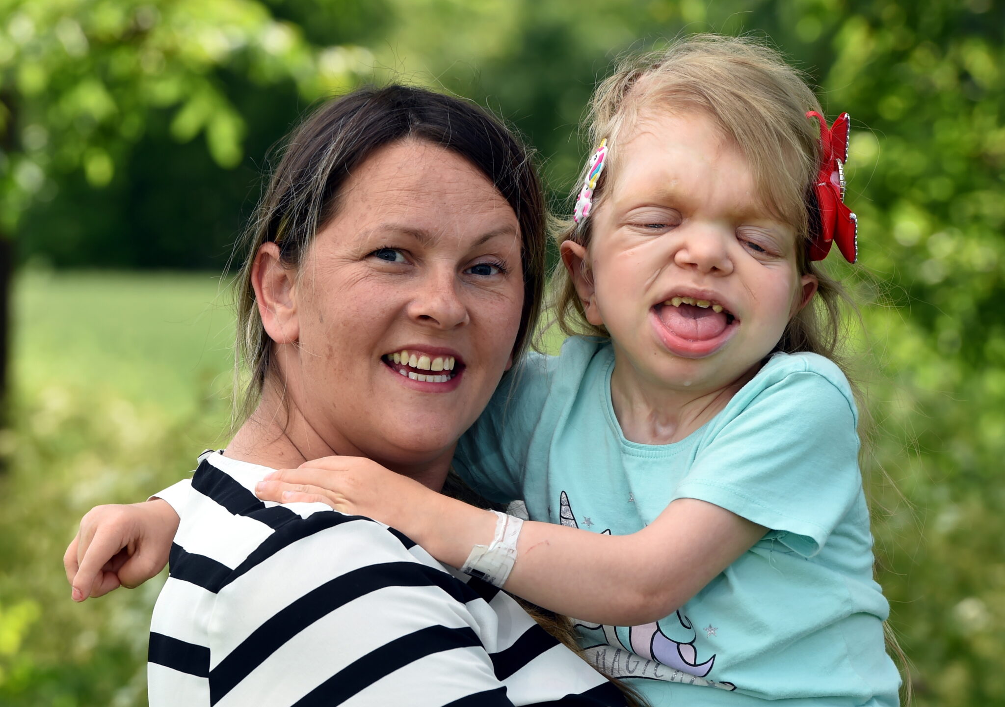 Aberdeenshire schoolgirl born with rare and life threatening Pfeiffer ...