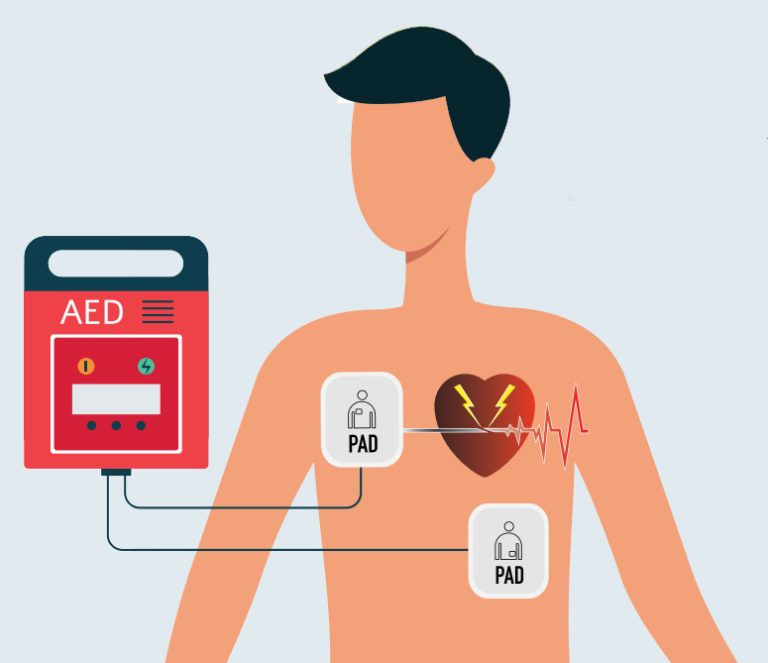 Defibrillator drones could be sent to Scots cardiac arrest victims