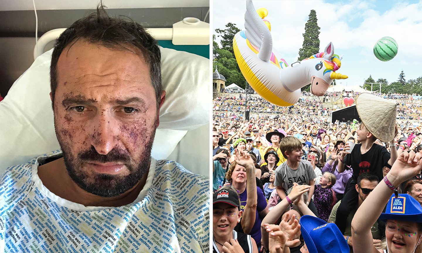 Three-hour surgery to reconstruct Belladrum festival goer's face after ...