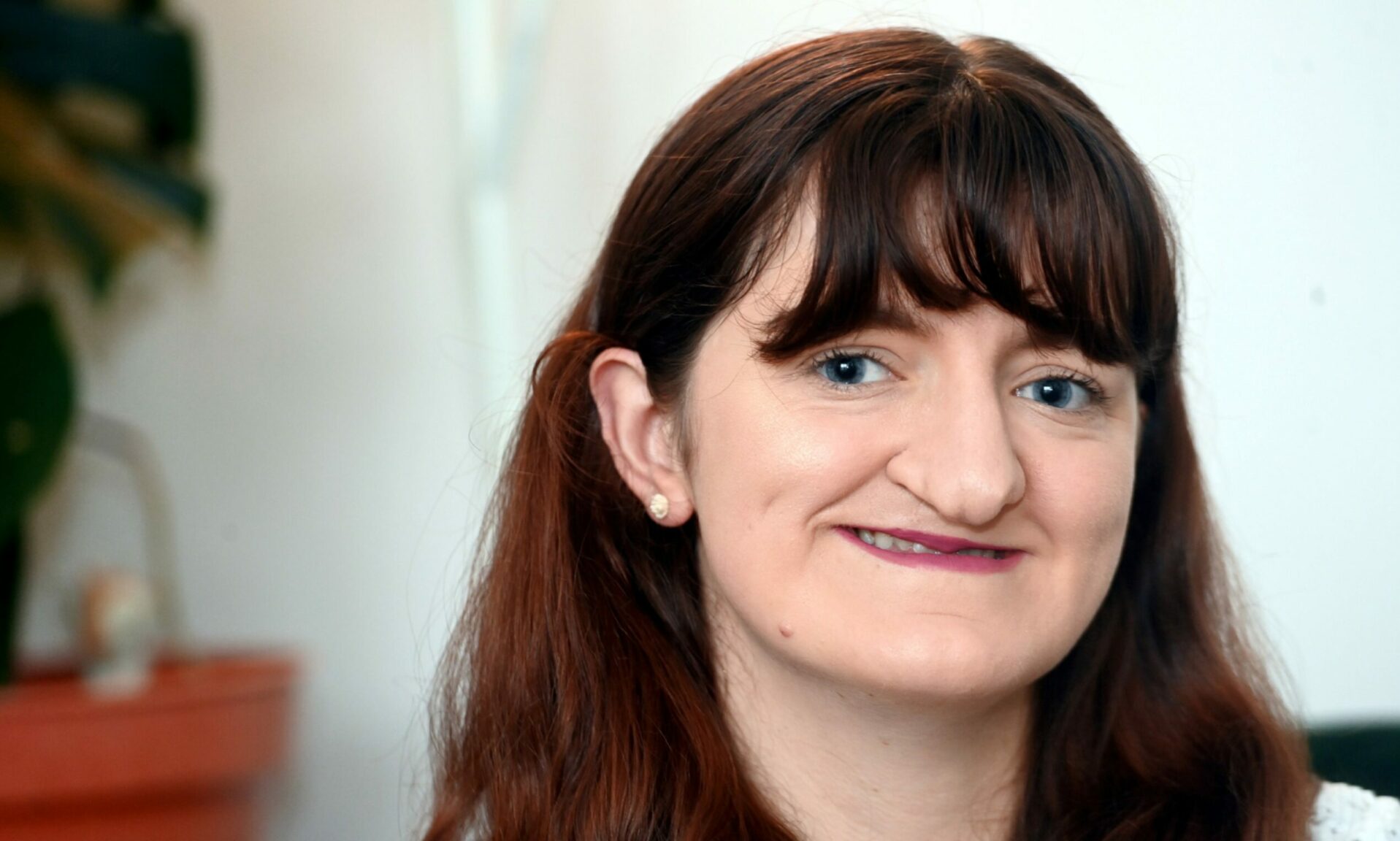 Living with visible differences: 3 women open up about their experiences