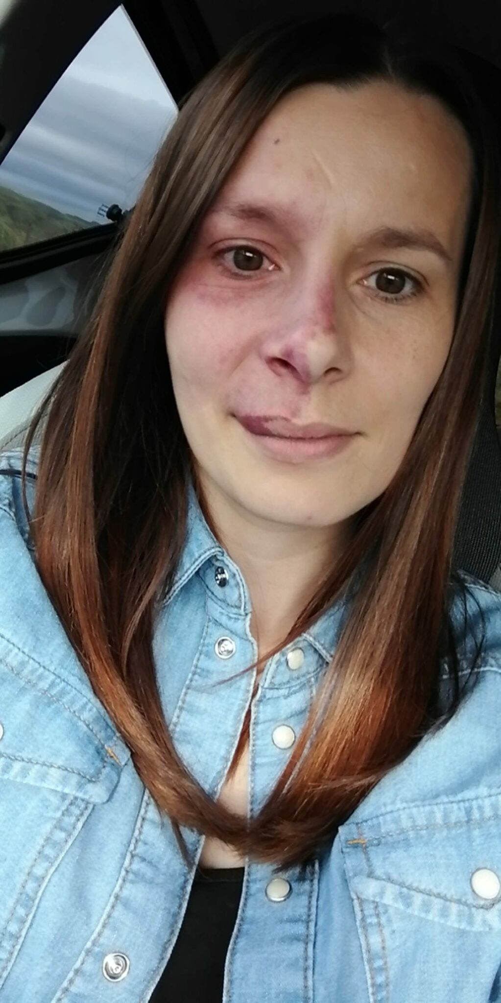 Living with visible differences: 3 women open up about their experiences