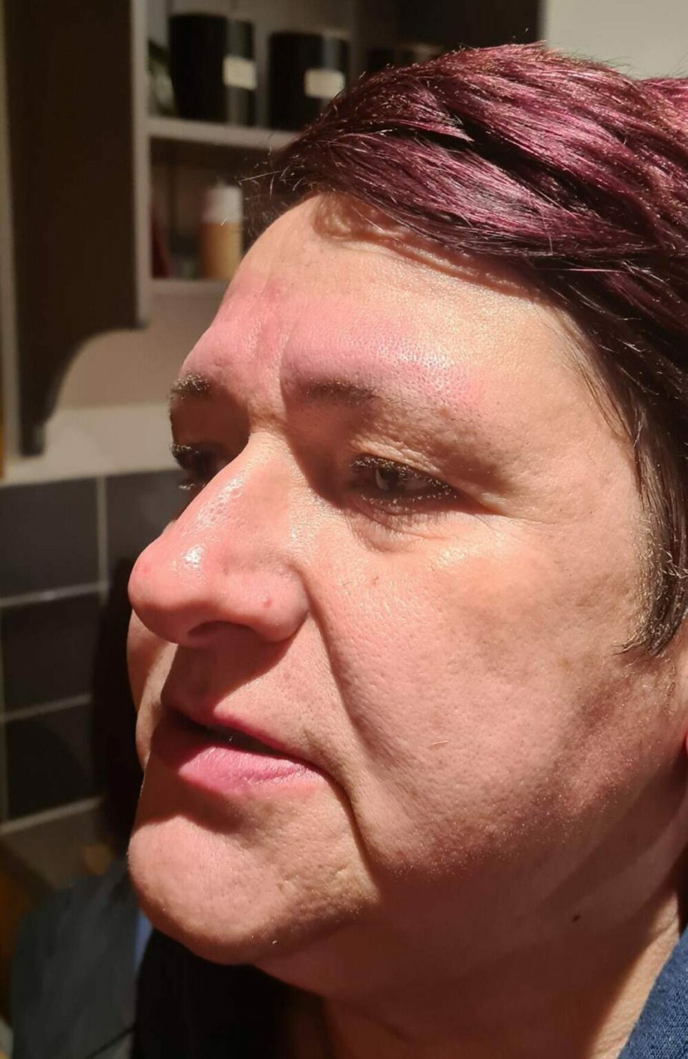 Aberdeen woman's eyebrows singed off by fire in Garthdee Nisa