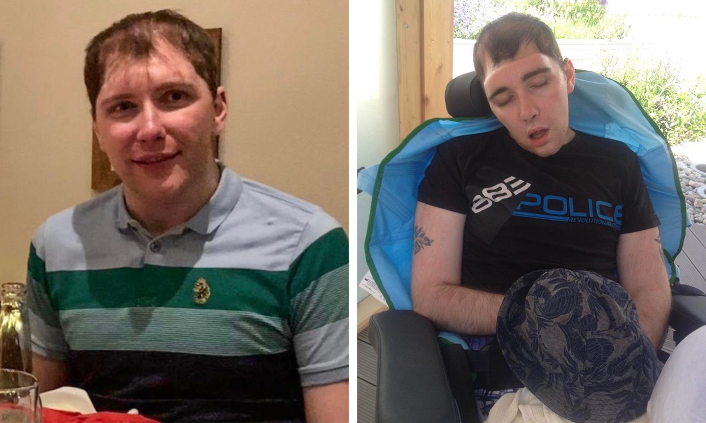 Fraserburgh 'miracle man' shocks NHS staff with recovery