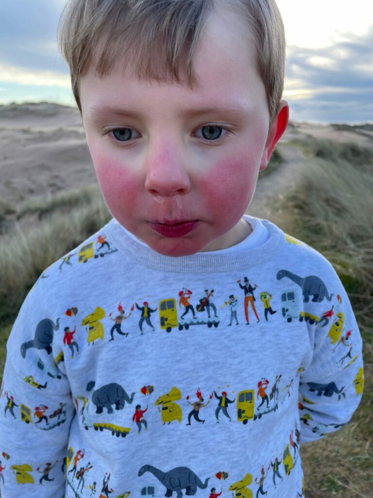 Lyme disease 'robbed' Aberdeenshire mum and son of life