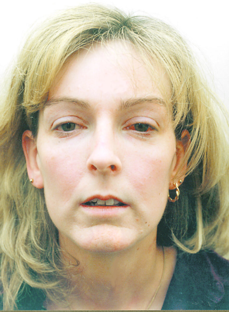 Arlene Fraser: The story of her disappearance