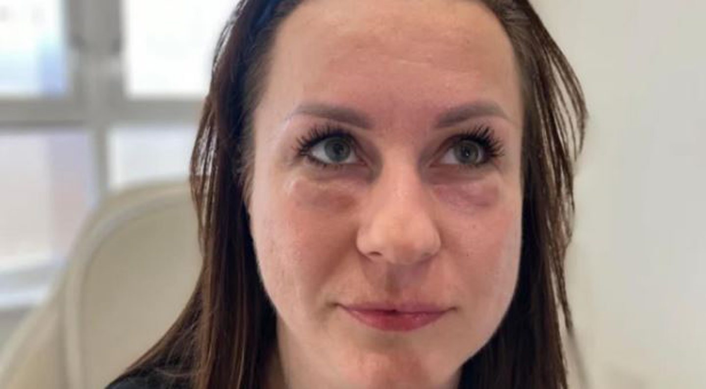 'People will die': Inverness clinic owner's botched Botox warning