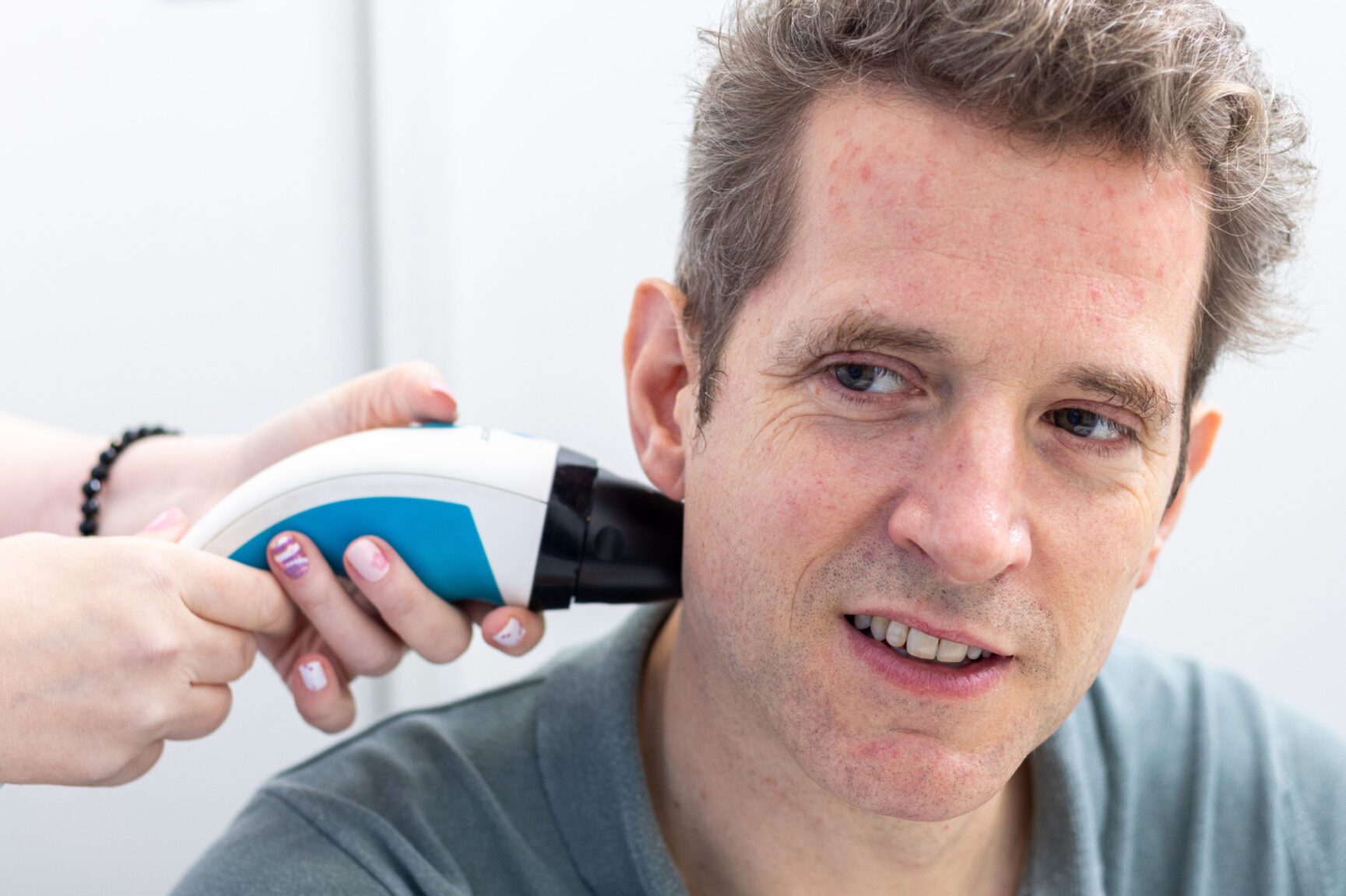 Aberdeen mole scan review: £60 skin cancer check explained