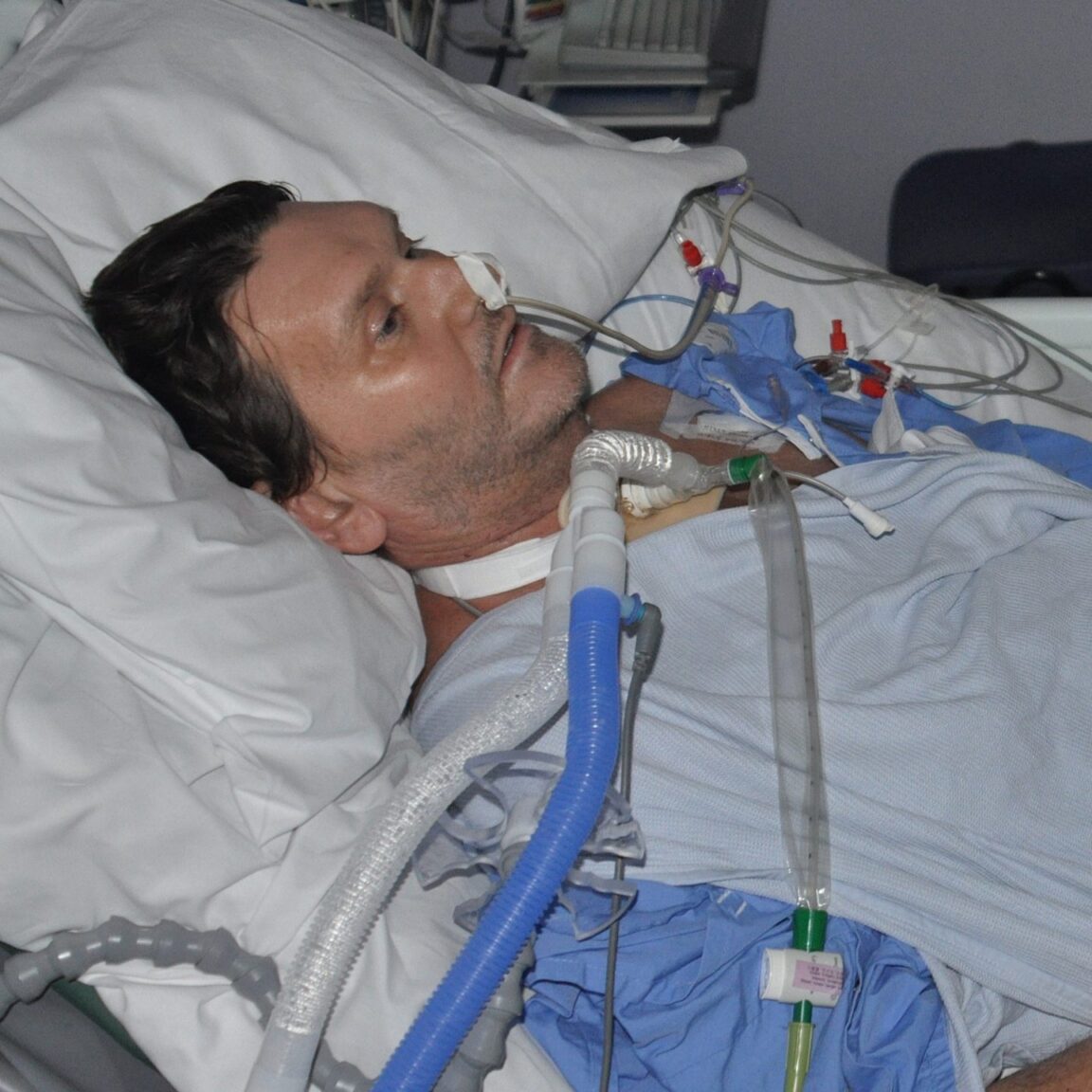 Elgin heart transplant man Brian Keeley gets PhD from Aberdeen